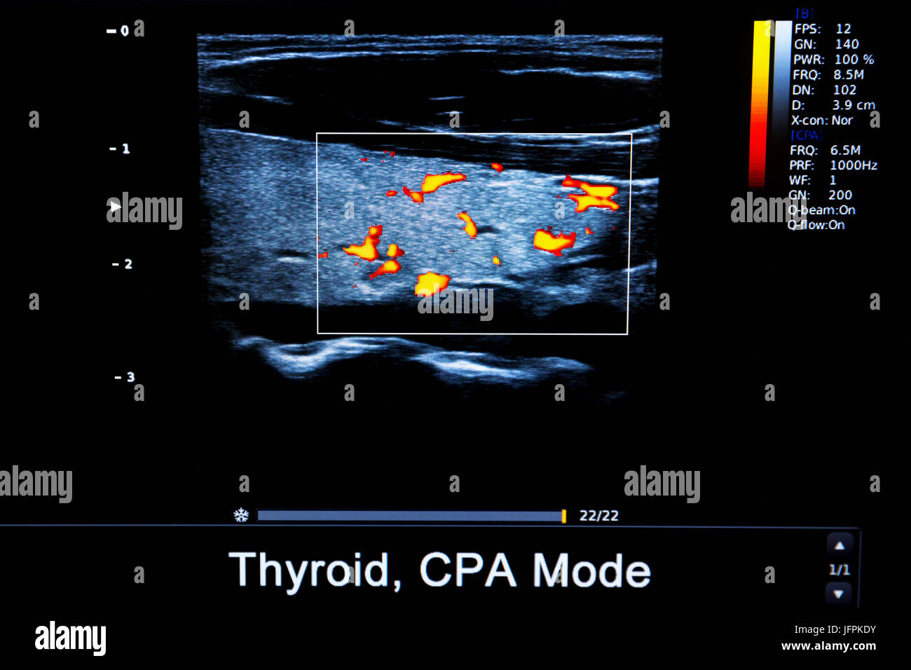 Colourful image of modern ultrasound monitor. Ultrasonography machine ...