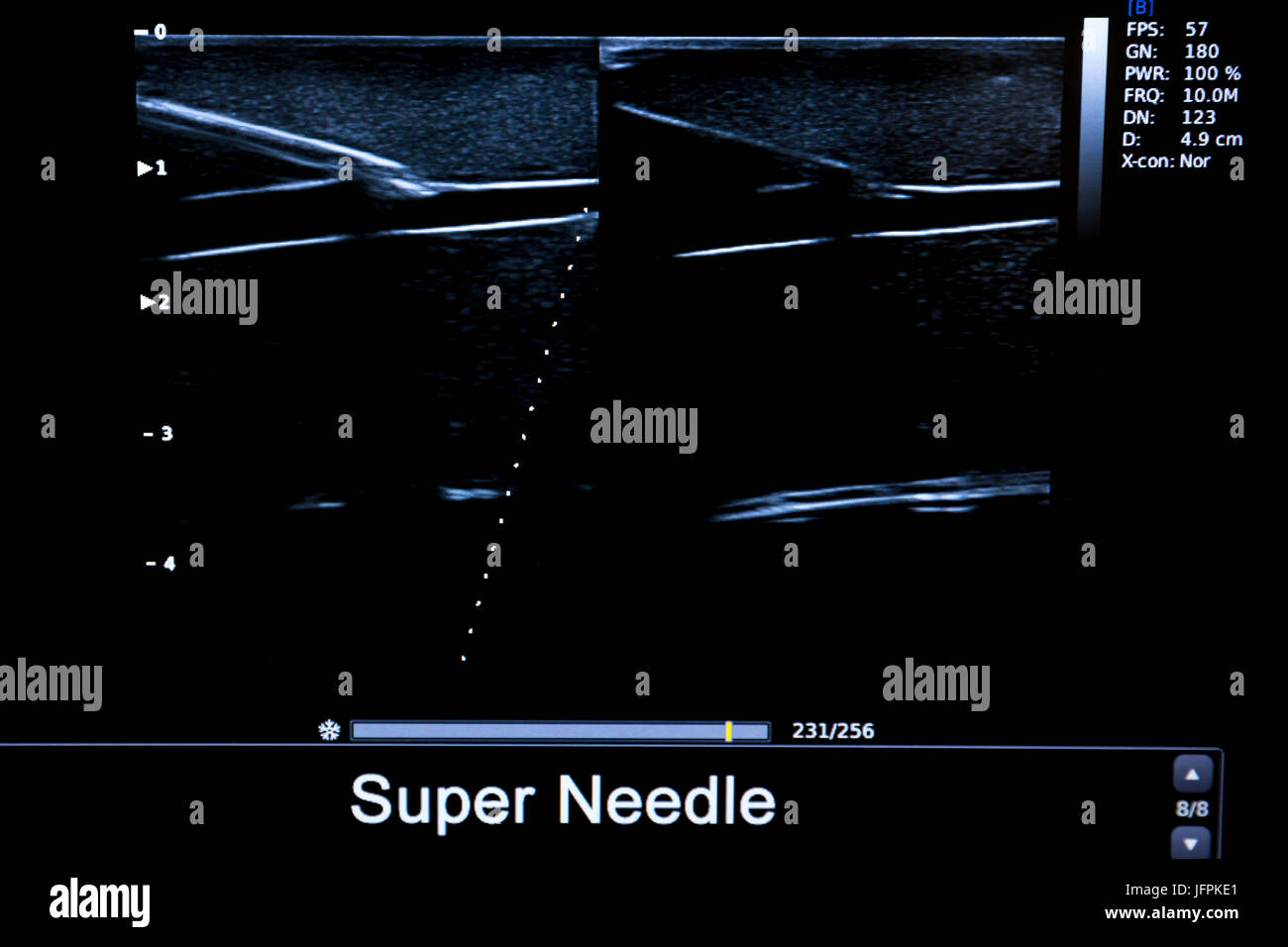 Colourful image of modern ultrasound monitor. Ultrasonography machine ...