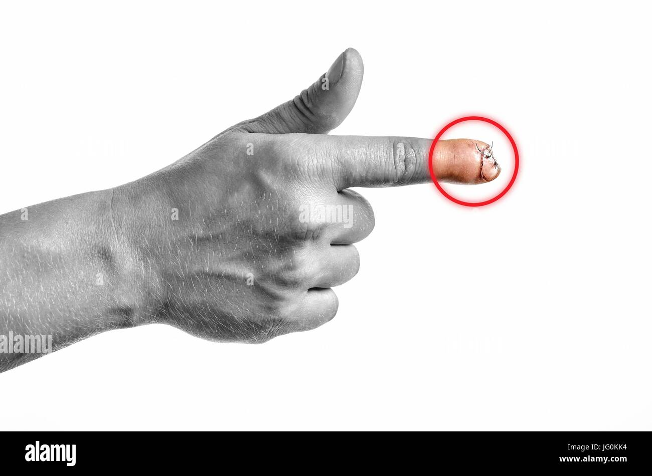 Finger nail damage hi-res stock photography and images - Alamy