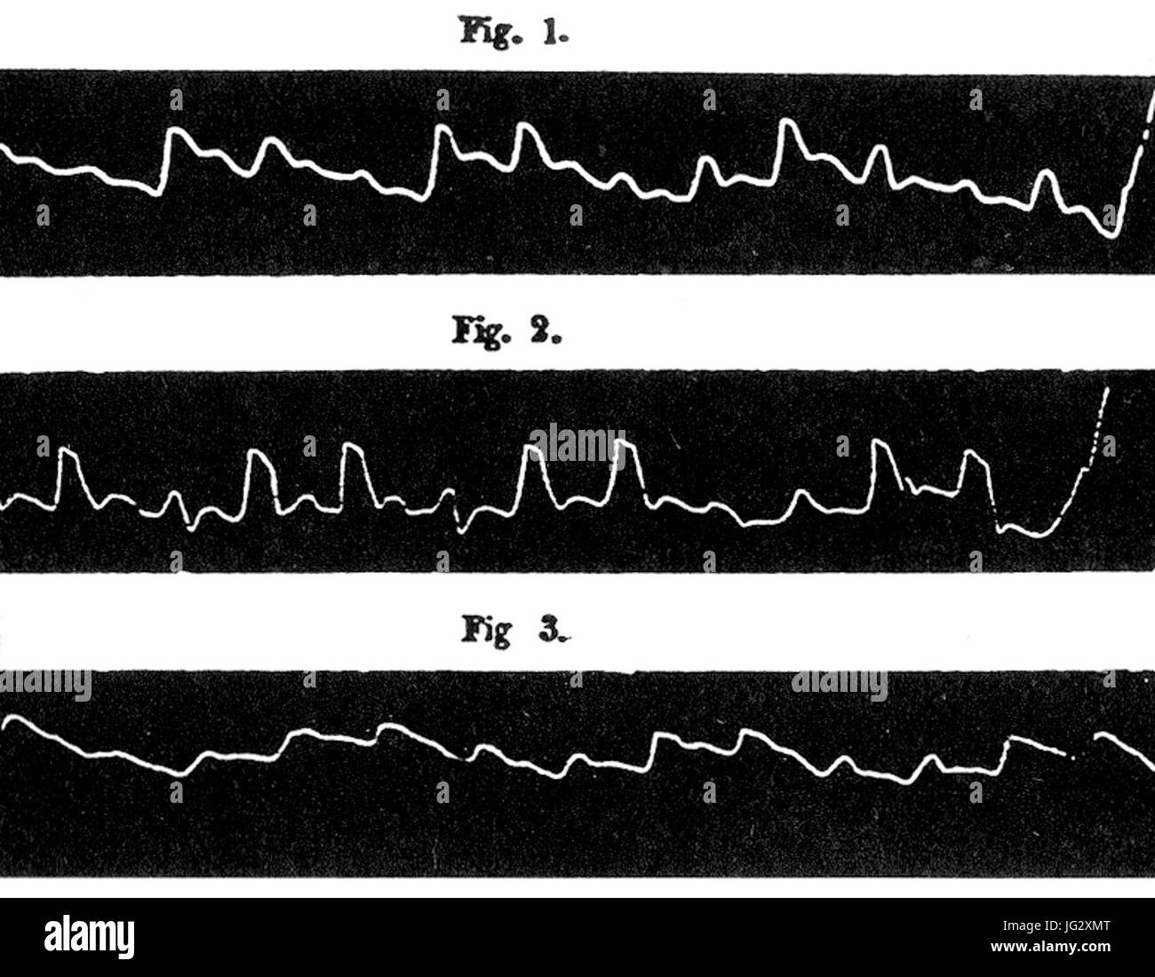 Kussmaul hi-res stock photography and images - Alamy