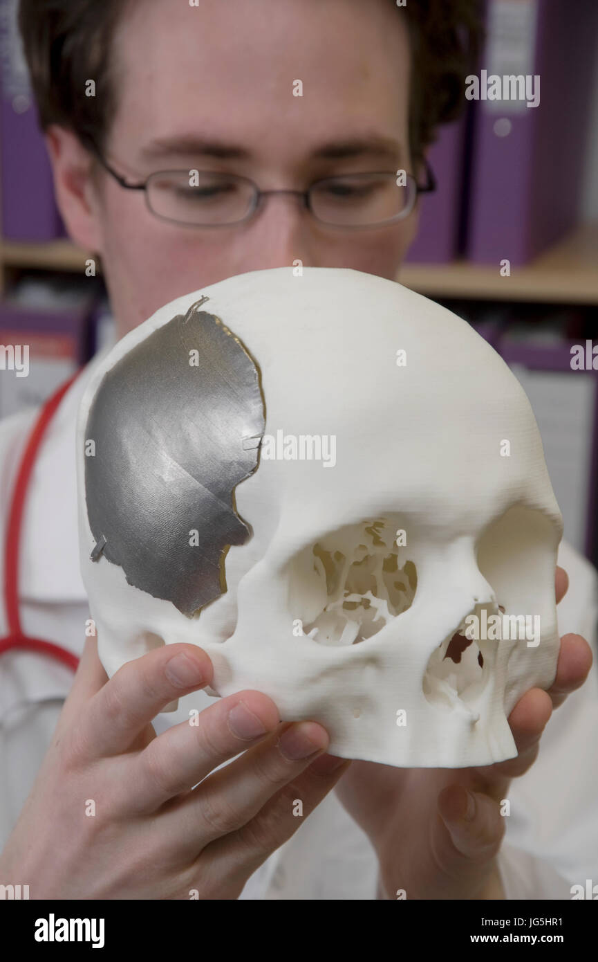 Metal plate for a specific cranial repair produced by Direct Metal ...