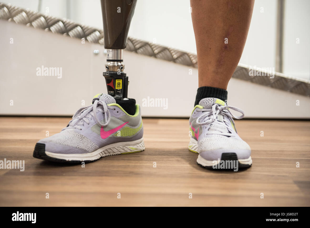A woman with a leg prothesis of the type 'Genium' of the company ...