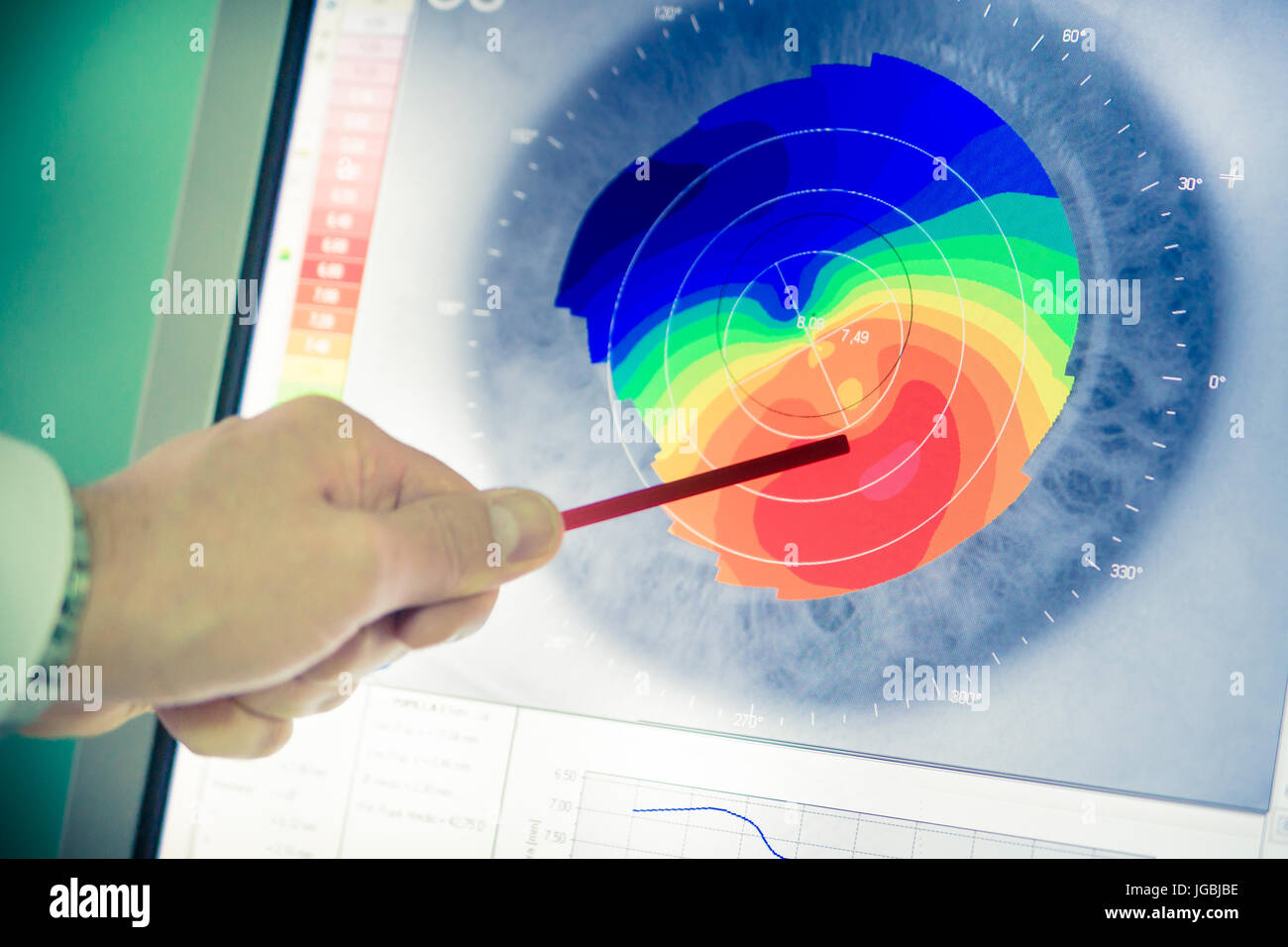 Topografía corneal hi-res stock photography and images - Alamy