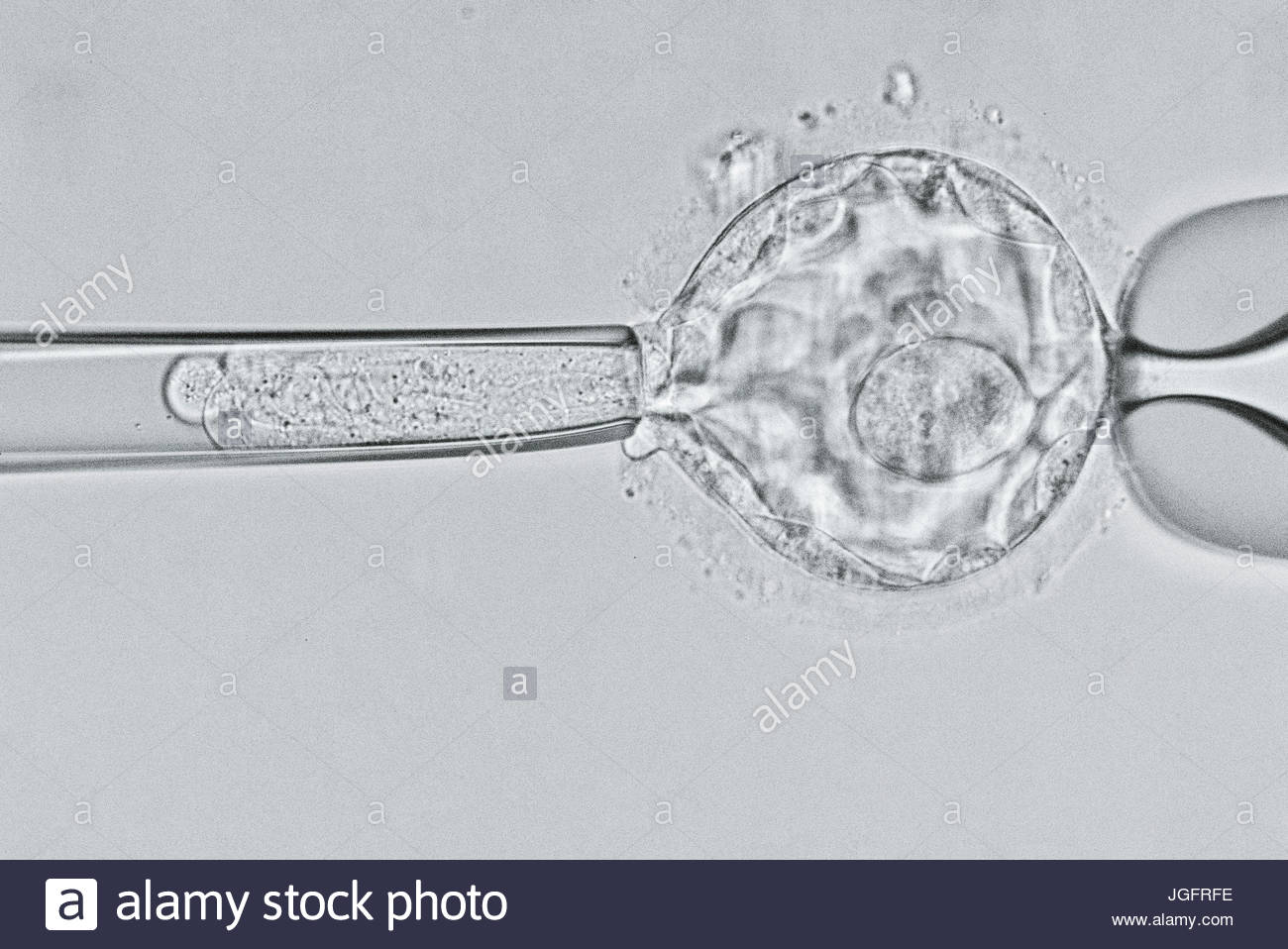 Blastocyst Embryo Stock Photos & Blastocyst Embryo Stock Images - Alamy