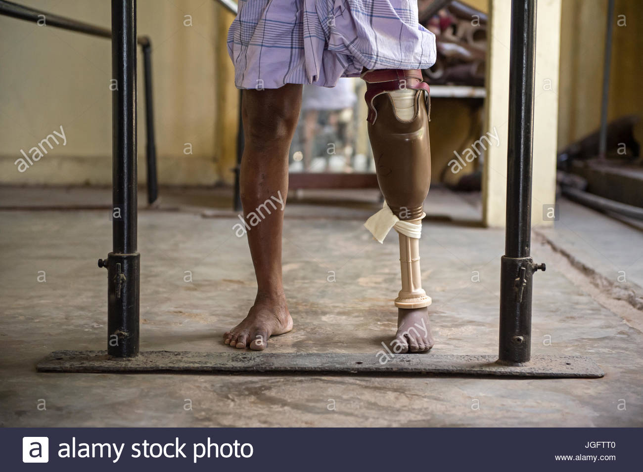 Amputated Stock Photos & Amputated Stock Images - Alamy