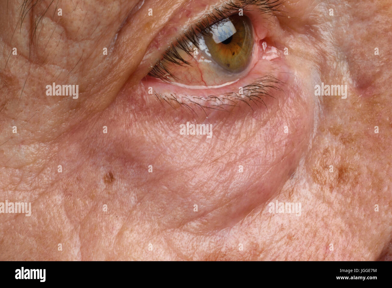 Bags under eyes hi-res stock photography and images - Alamy