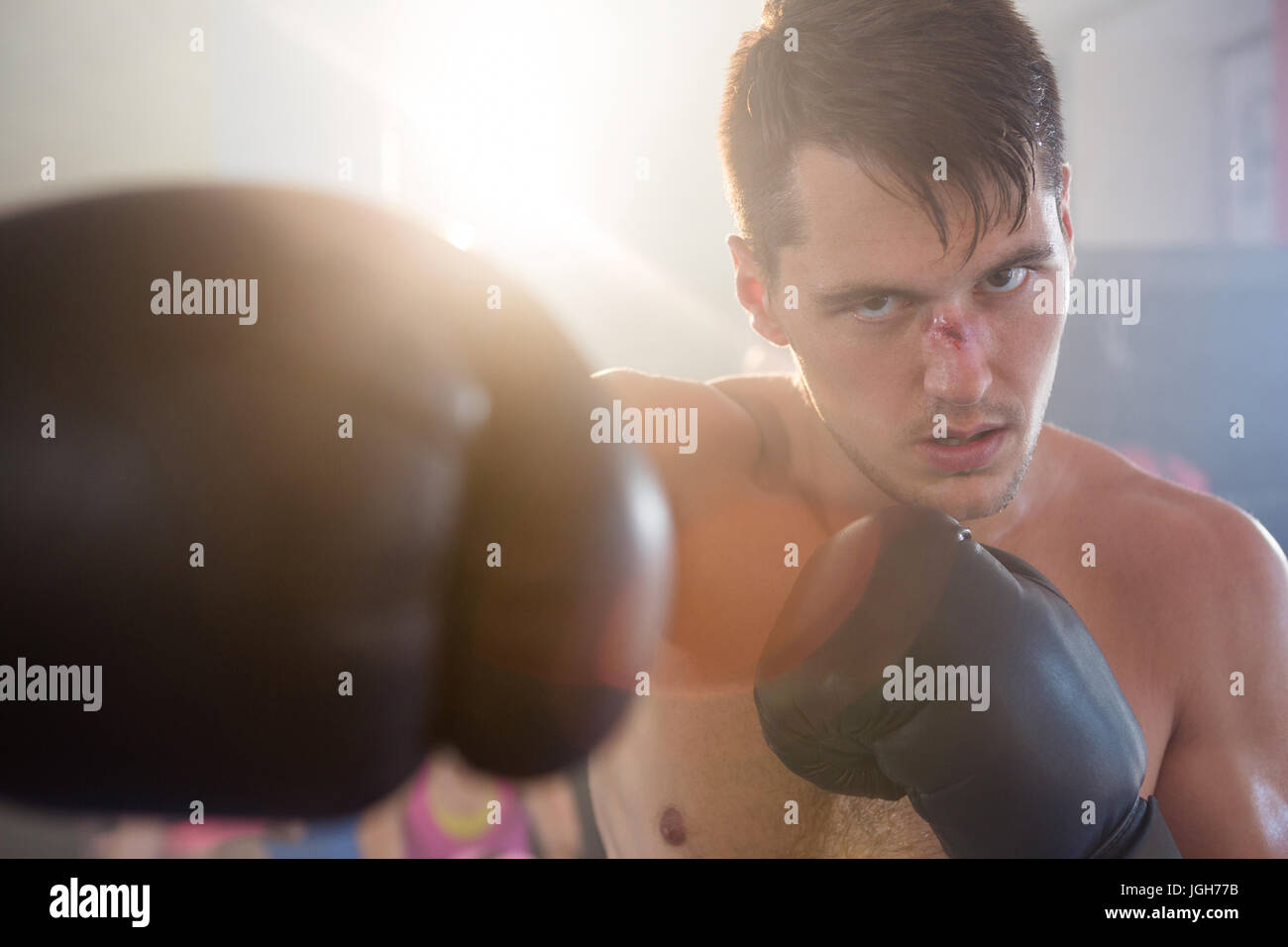 Bleeding Nose Stock Photos & Bleeding Nose Stock Images - Alamy