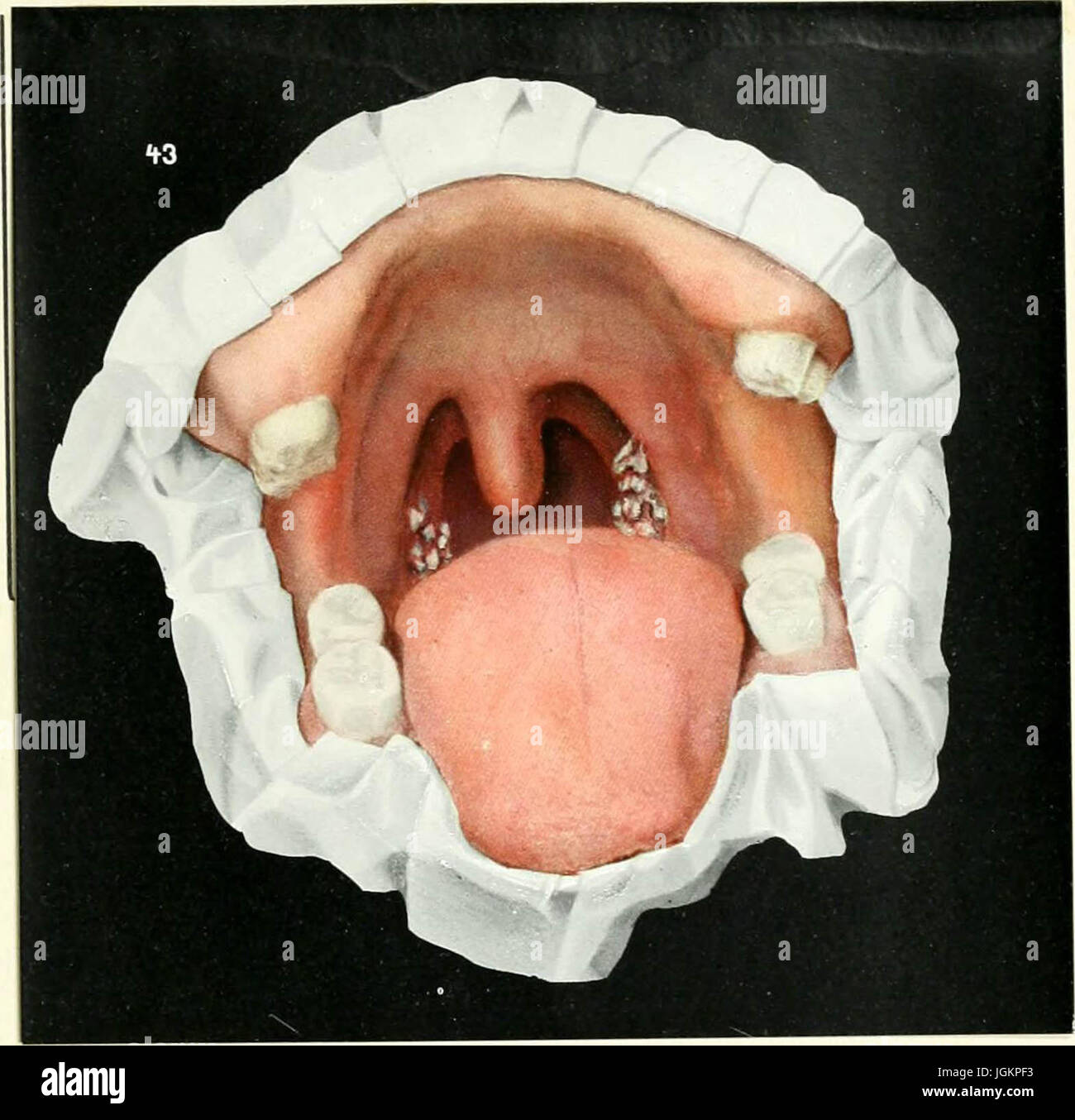 "Diseases of the mouth; for physicians, dentists, medical and dental ...