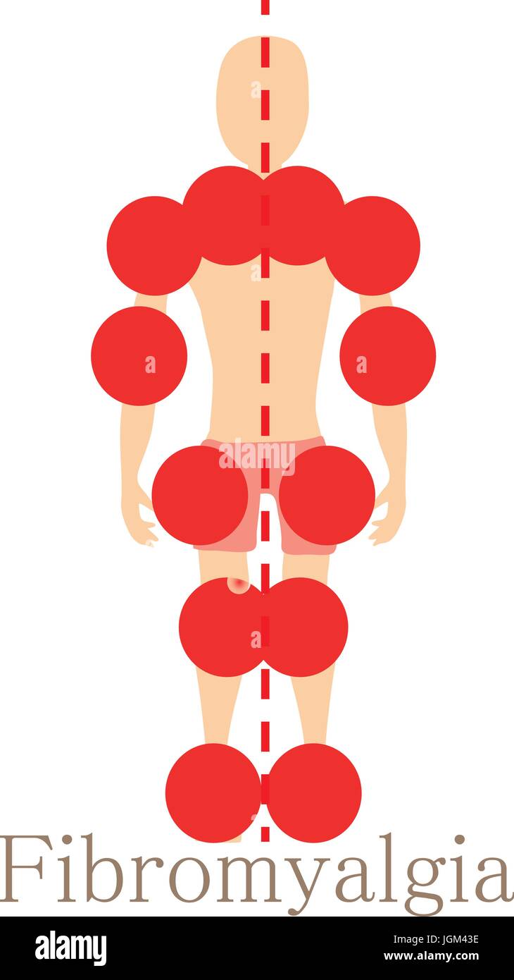 Chest Pain Cartoon Character Stock Vector Images - Alamy