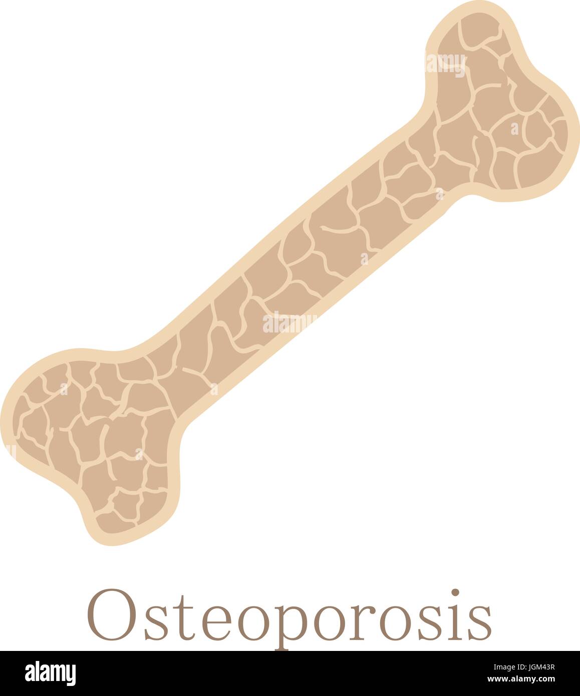 Osteoporosis bone icon, cartoon style Stock Vector Image & Art - Alamy