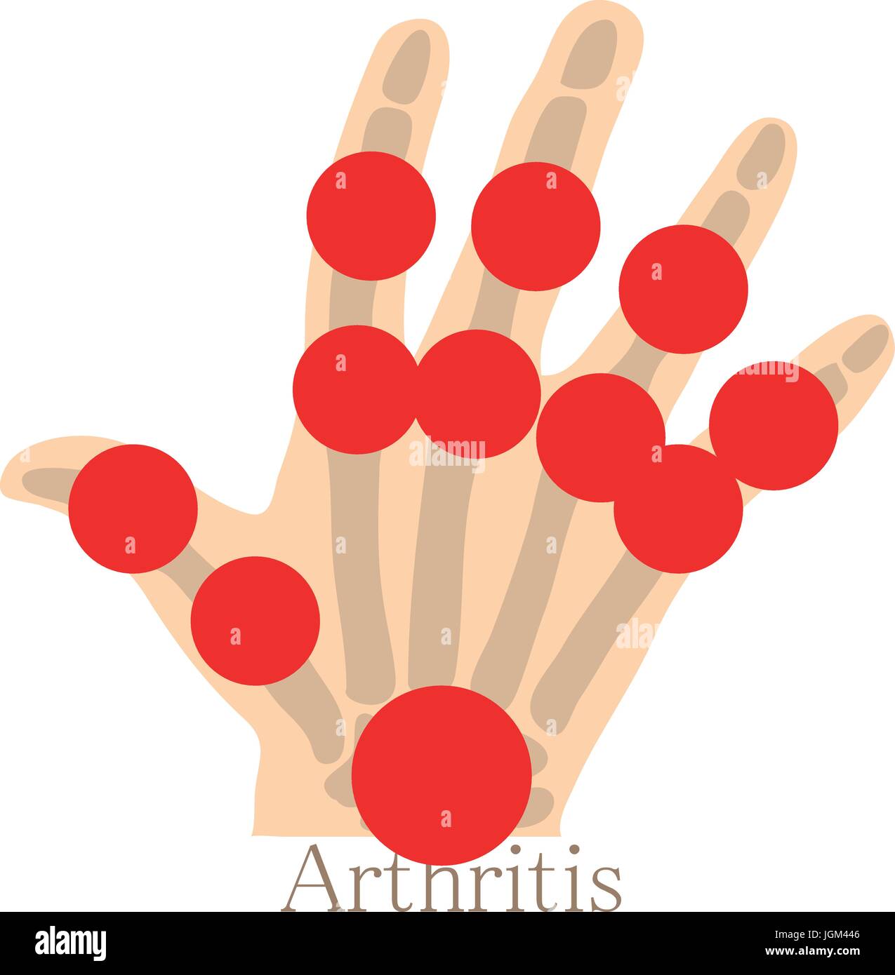 Arthritis hand icon, cartoon style Stock Vector Image & Art - Alamy