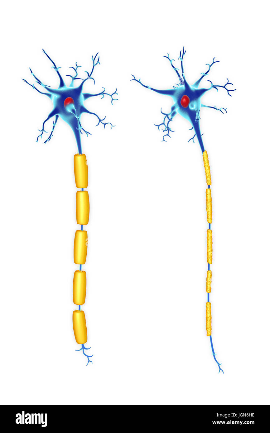 Illustration of two nerves cells (neurons). They both have a myelin ...