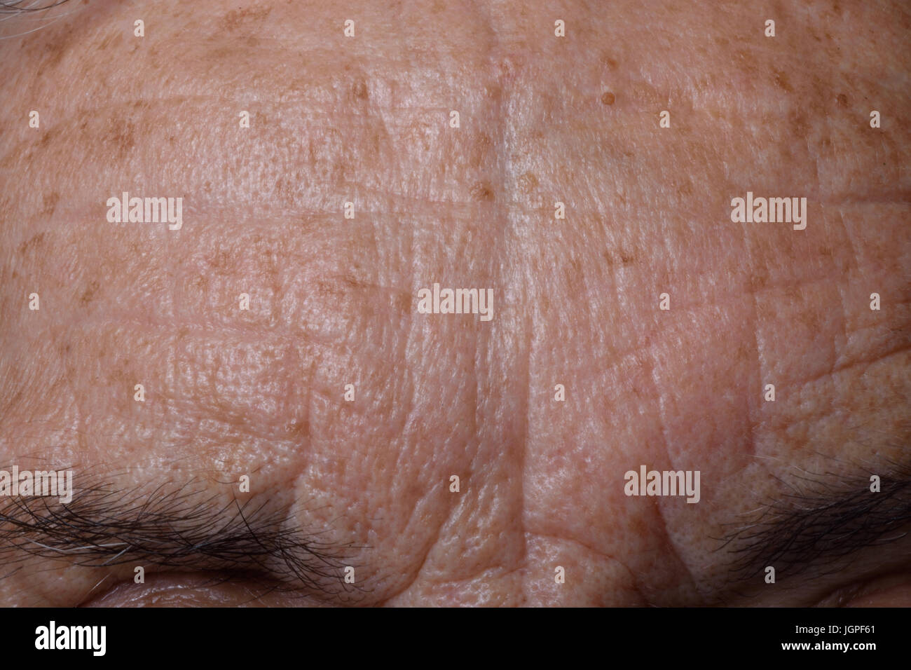 Wrinkled Forehead High Resolution Stock Photography and Images - Alamy