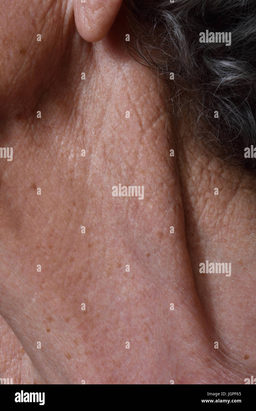 Wrinkles on the neck hi-res stock photography and images - Alamy
