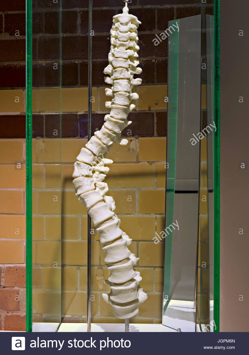 Curvature Of The Spine Stock Photos & Curvature Of The Spine Stock ...