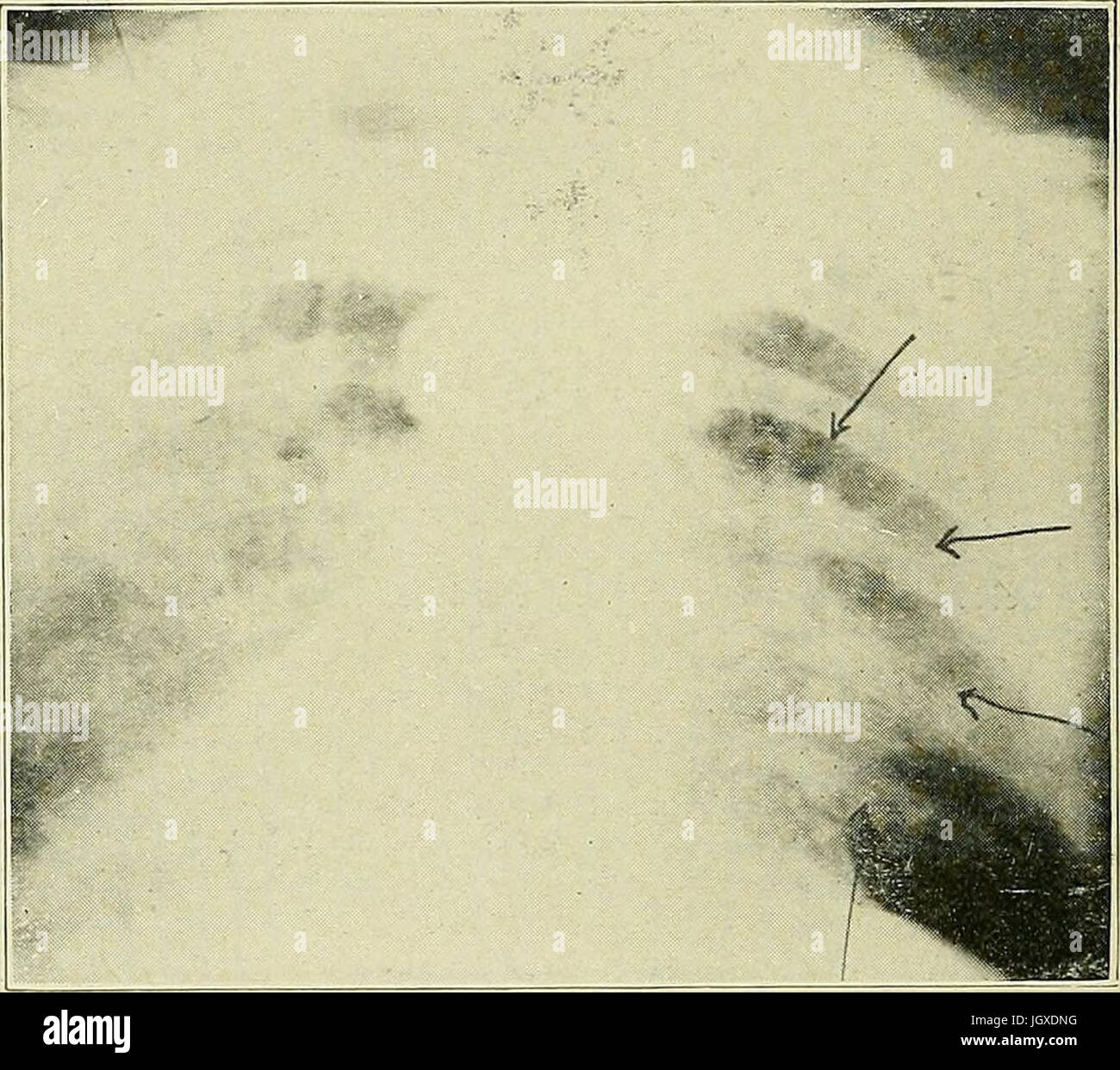 Old syphilis hi-res stock photography and images - Alamy