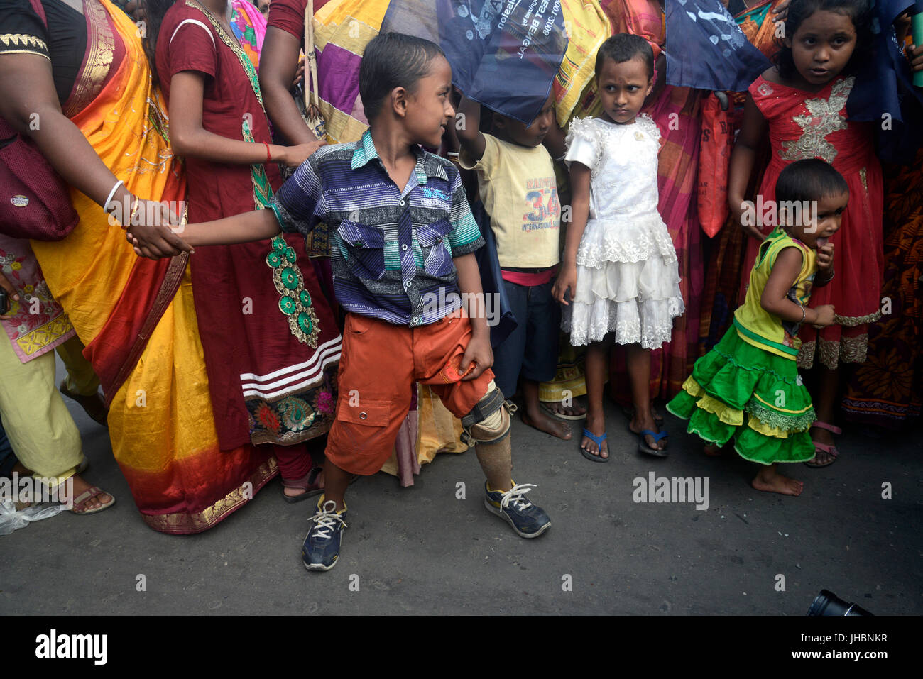 Prosthetic leg child hi-res stock photography and images - Alamy