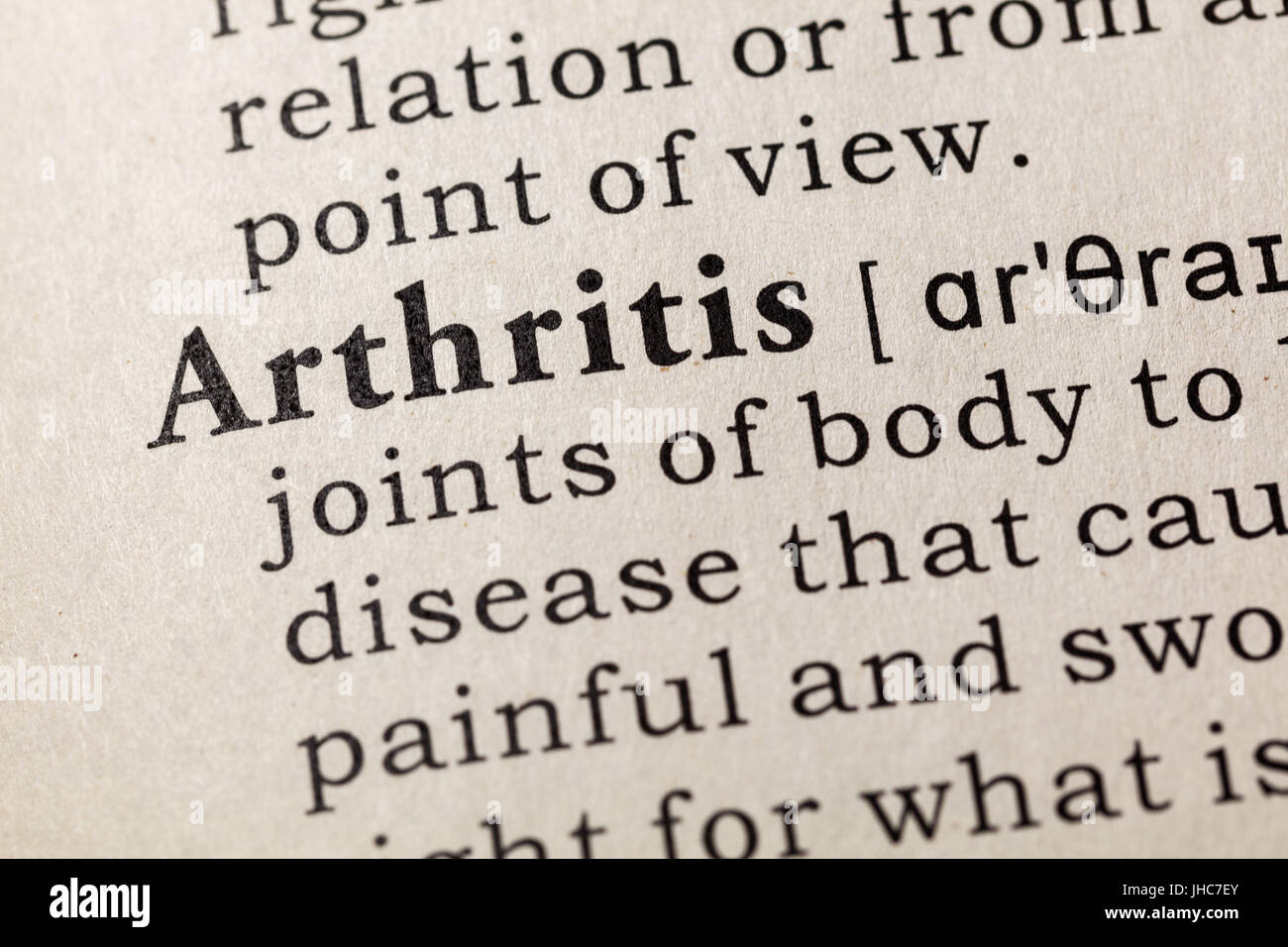 Arthritis disease hi-res stock photography and images - Alamy