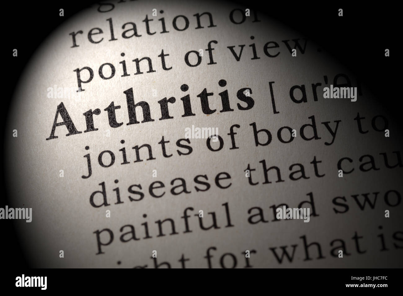 Arthritis disease hi-res stock photography and images - Alamy