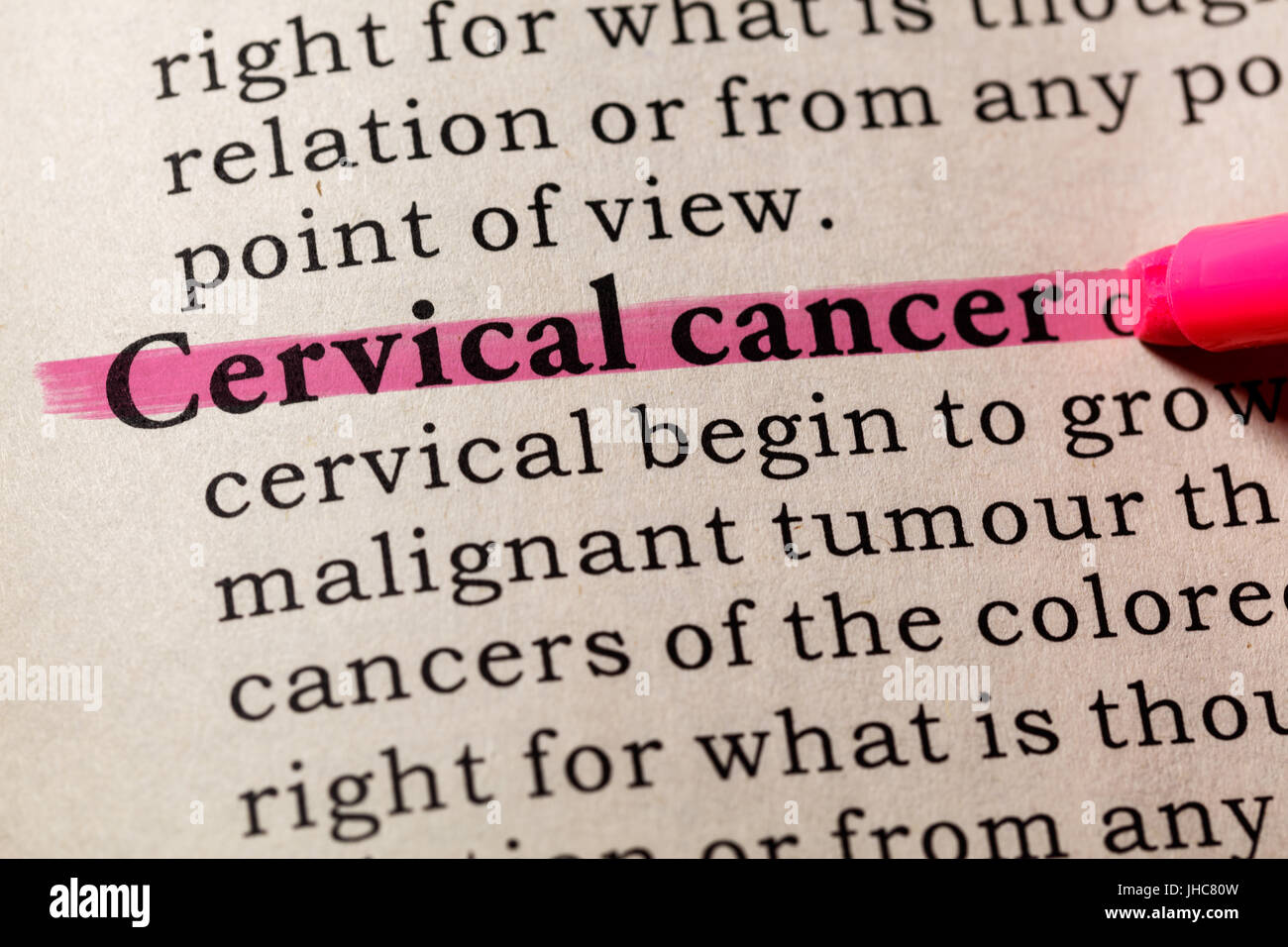 Fake Dictionary, Dictionary definition of the word cervical cancer ...