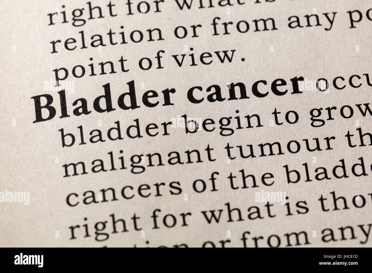 Bladder cancer hi-res stock photography and images - Alamy