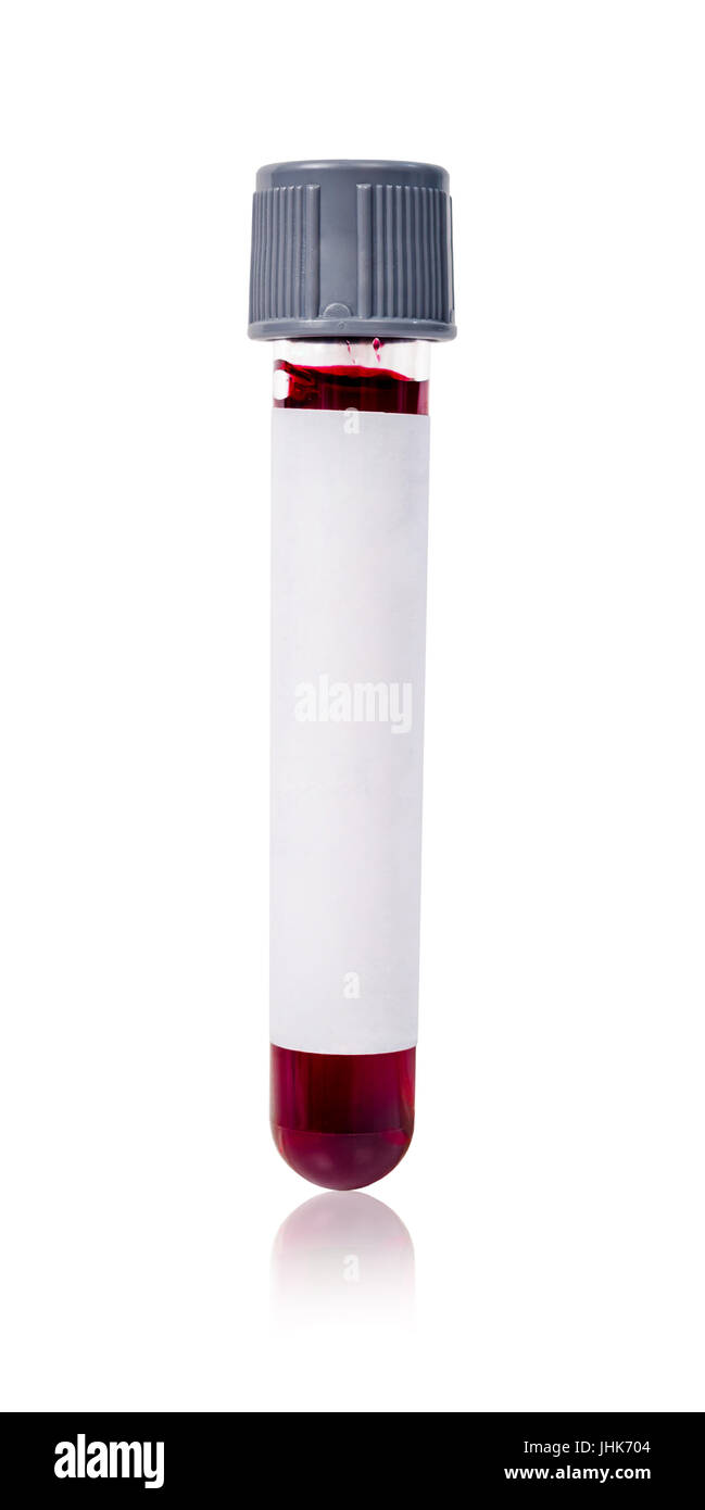 Grey vacuum blood tube test with sample blood for Medical laboratory ...