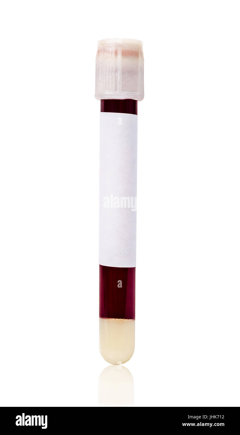 White vacuum blood tube test with sample blood for Medical laboratory ...