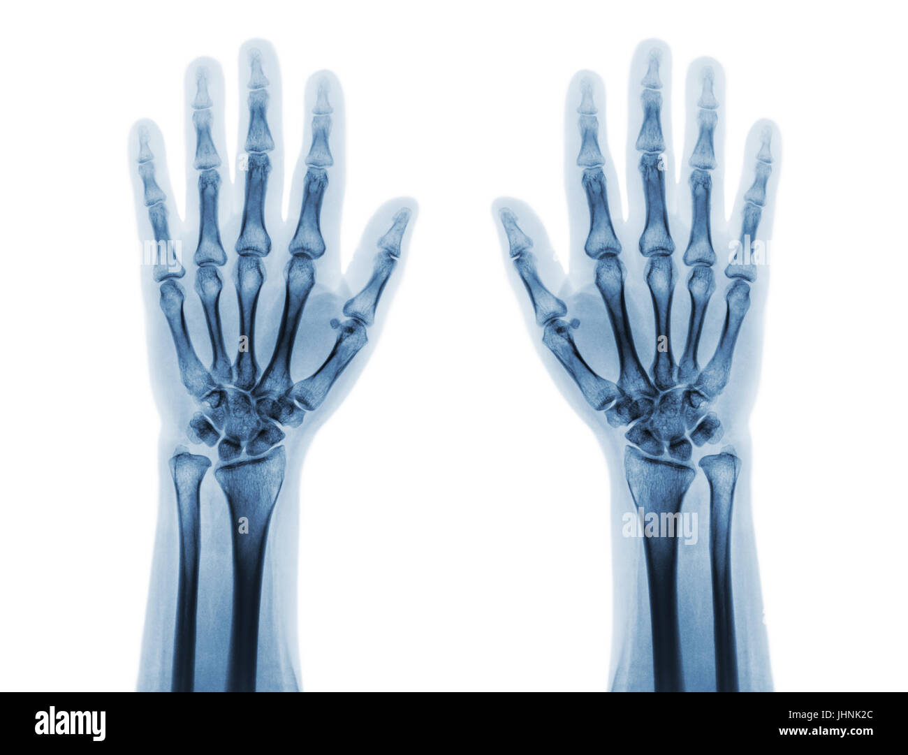 Normal hand imaging medical hi-res stock photography and images - Alamy