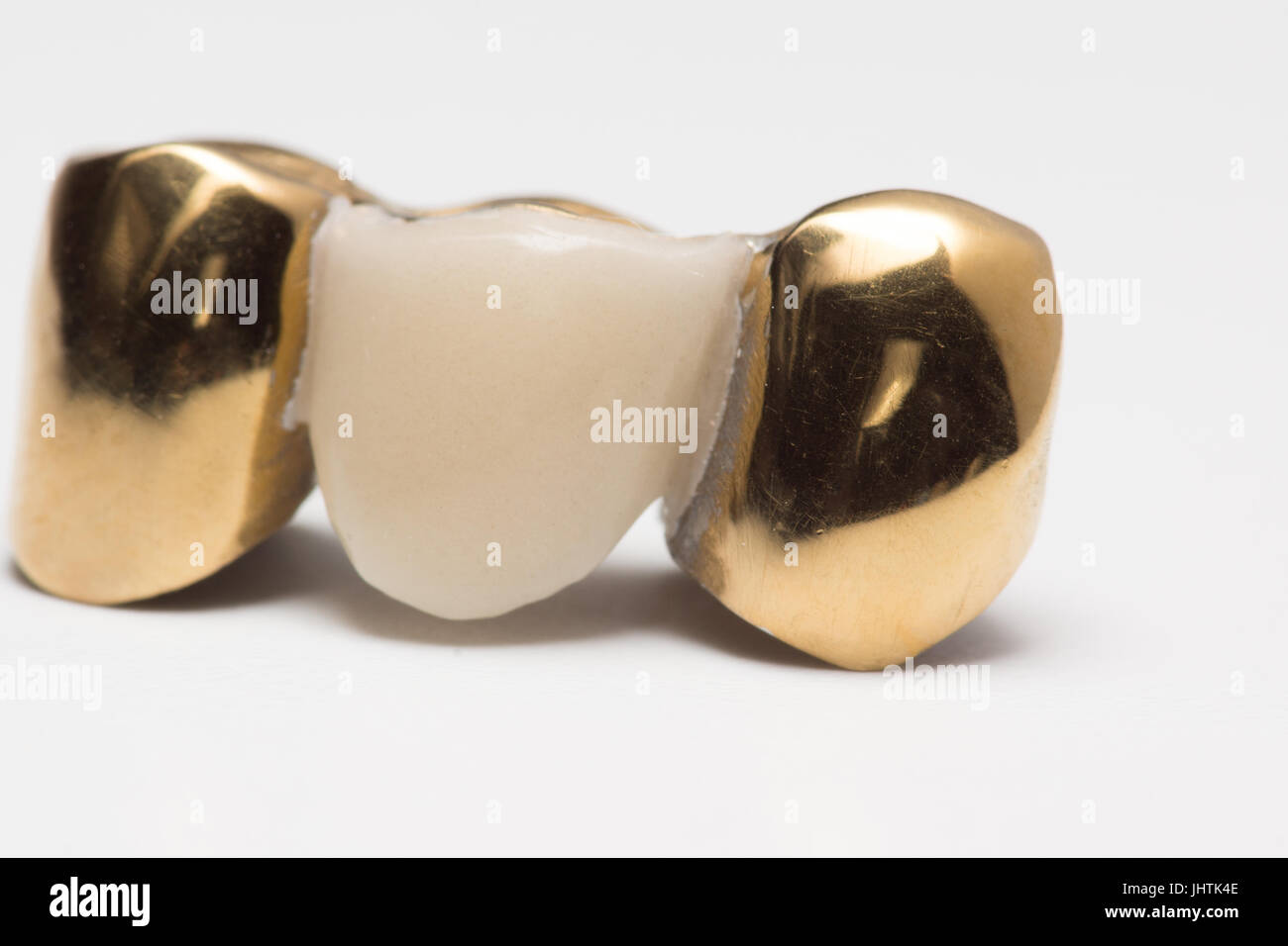 Steel artificial dental crown for dentition restoration Stock Photo - Alamy