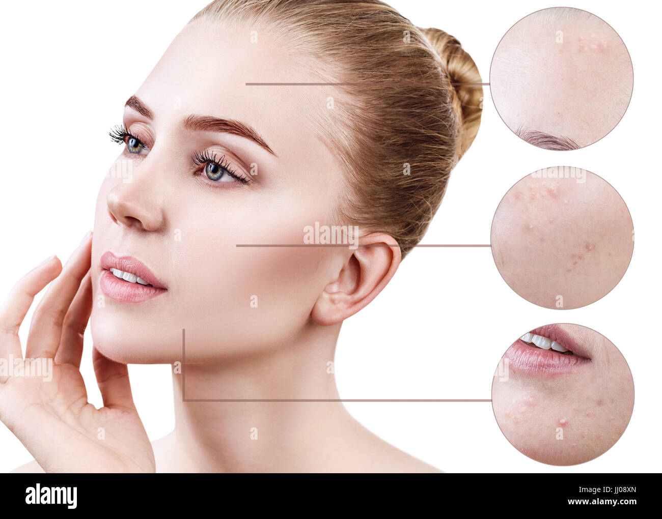 Circles shows problem skin of young woman Stock Photo - Alamy