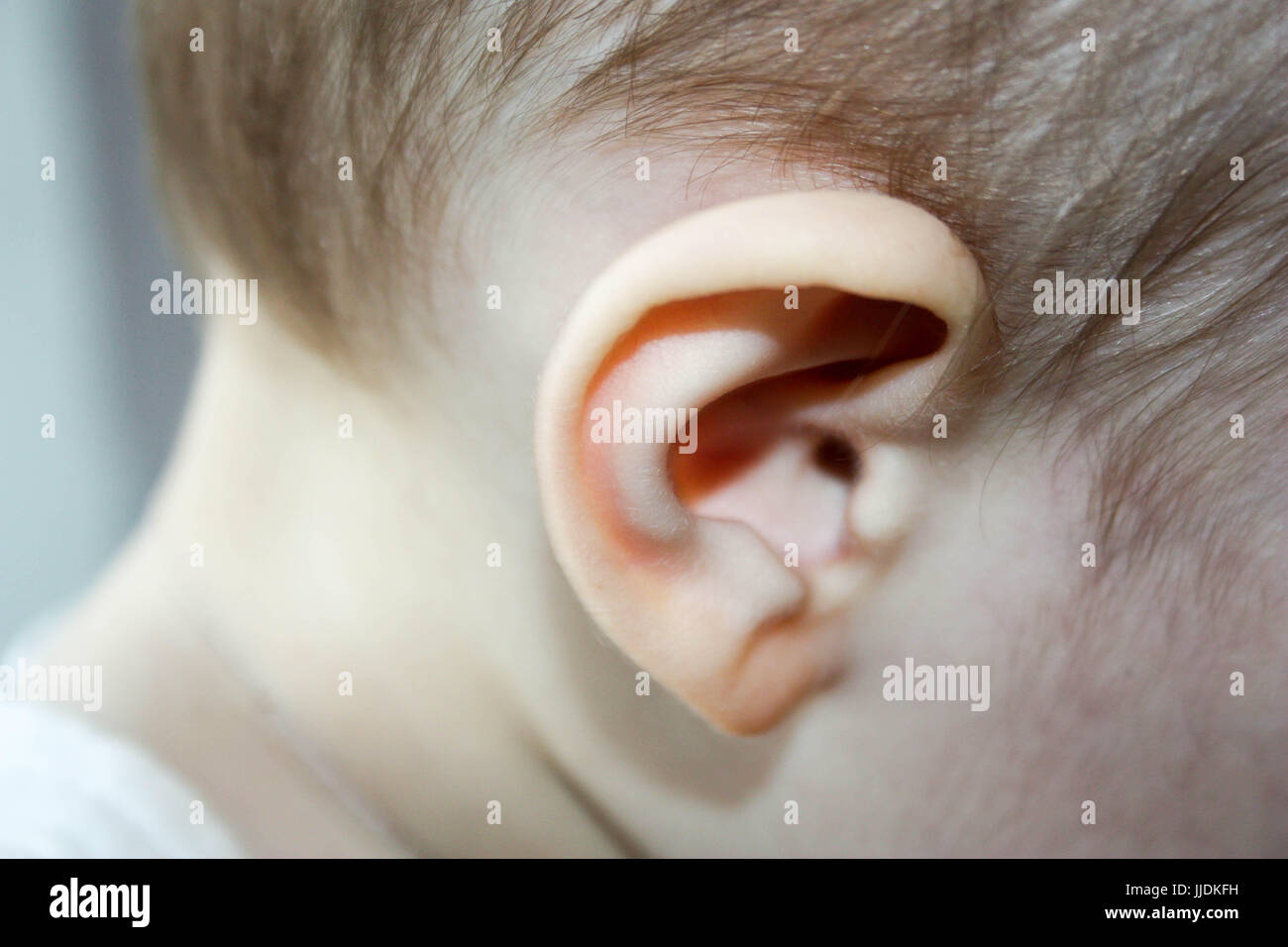 earache. Atit child. Ear close-up. Child boy. Photo for your design ...