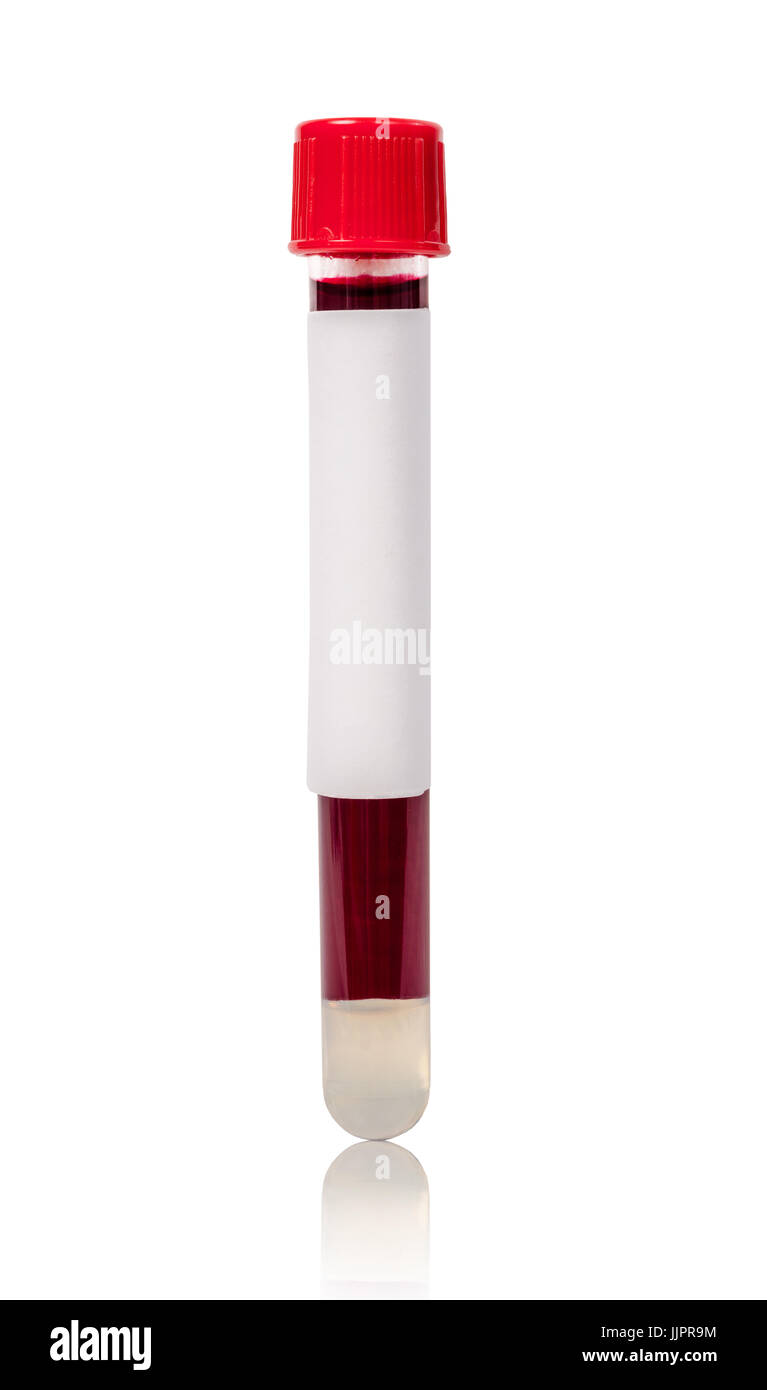 Red vacuum blood tube test with sample blood for Medical laboratory ...