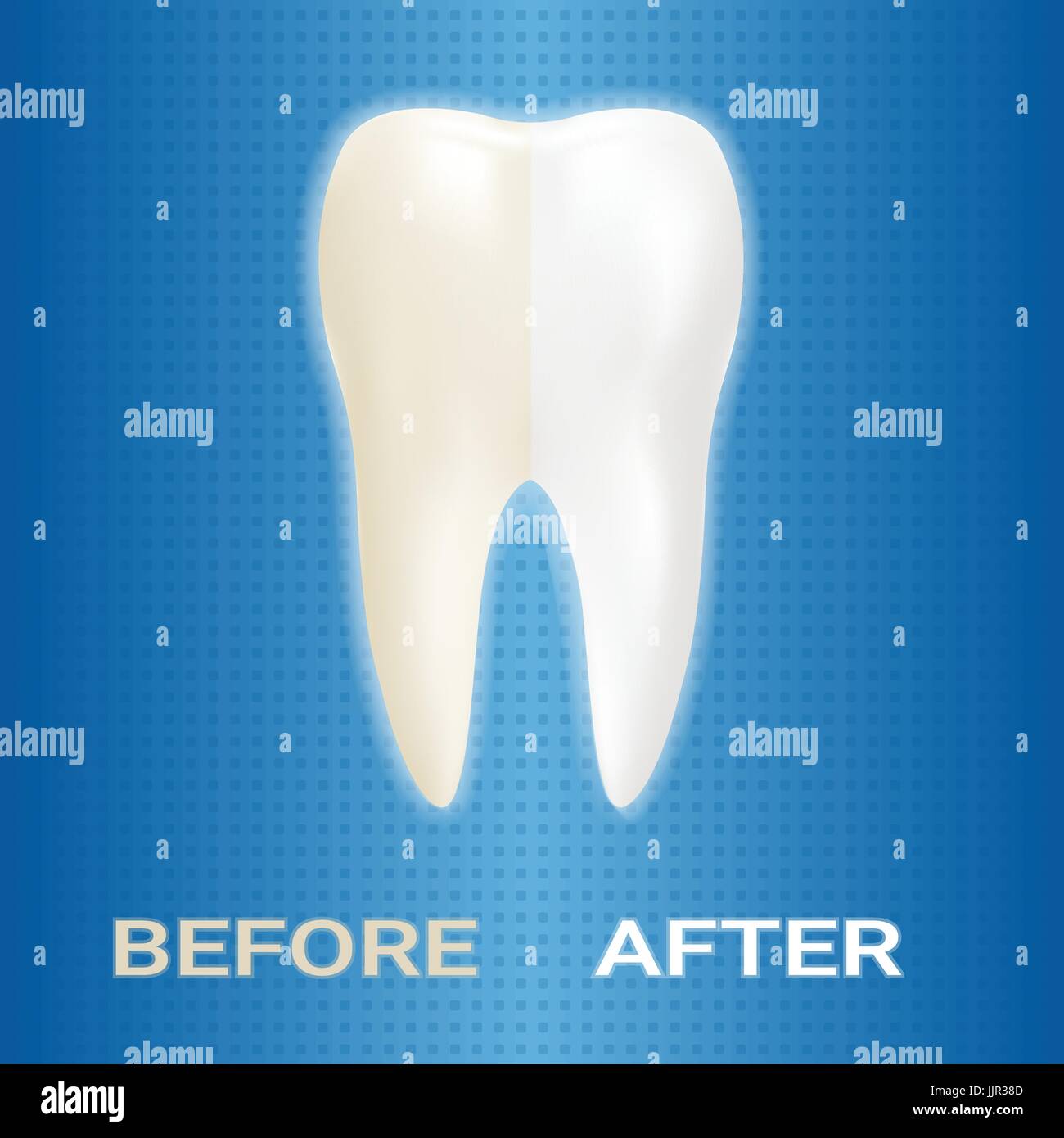 Dental Veneer, Whitening Of Human Tooth, Whitening Toothpaste Isolated ...