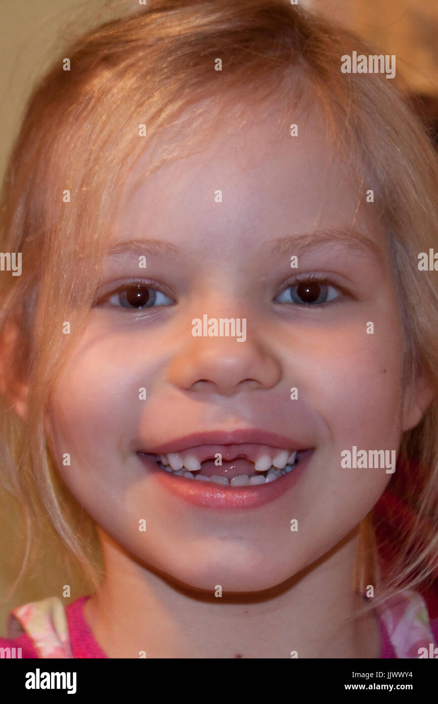 A portrait of a young smiling girl with her middle teeth mising Stock ...