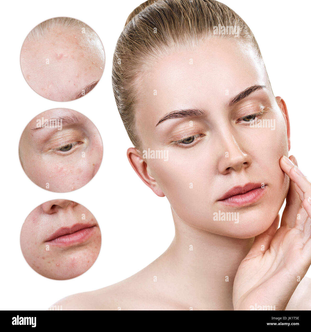 Circles shows problem skin of young woman Stock Photo - Alamy