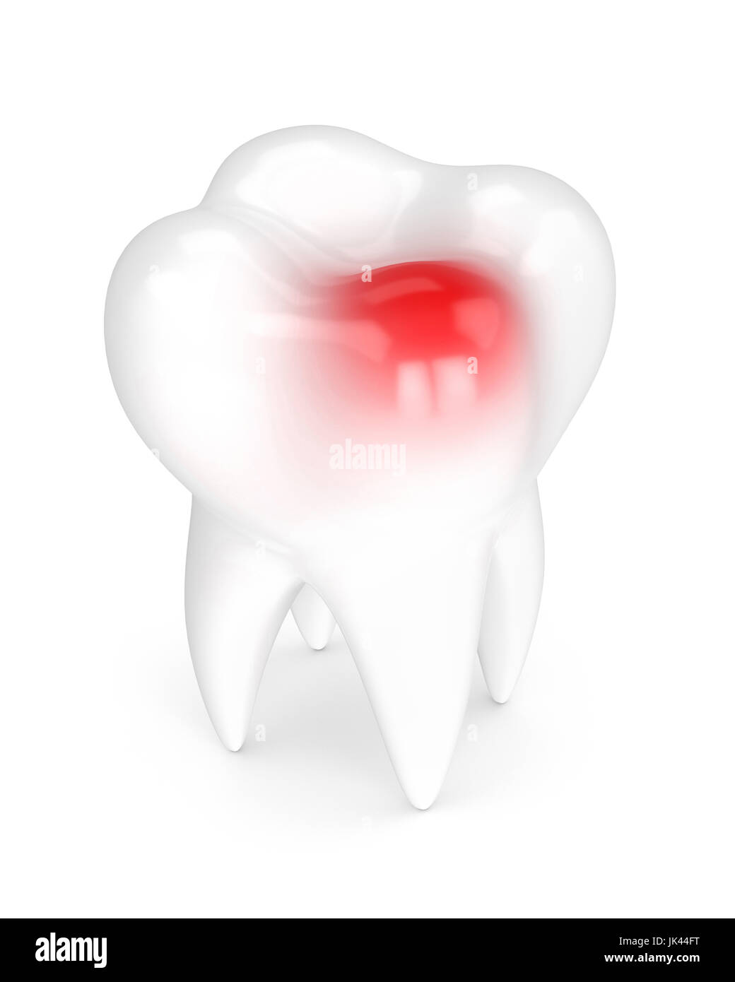 3d render of tooth with toothache isolated over white background Stock ...