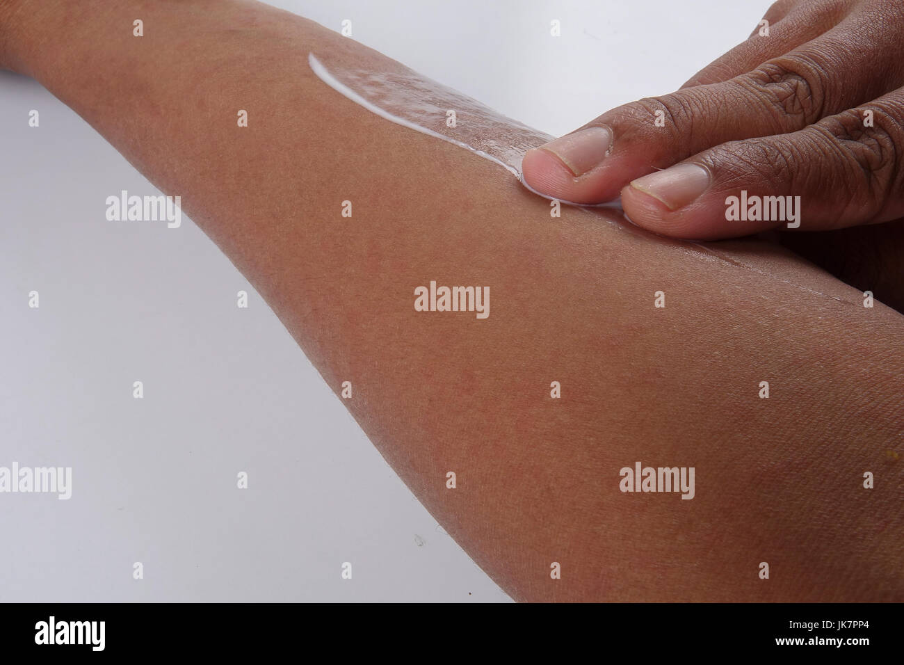 Rash hi-res stock photography and images - Alamy
