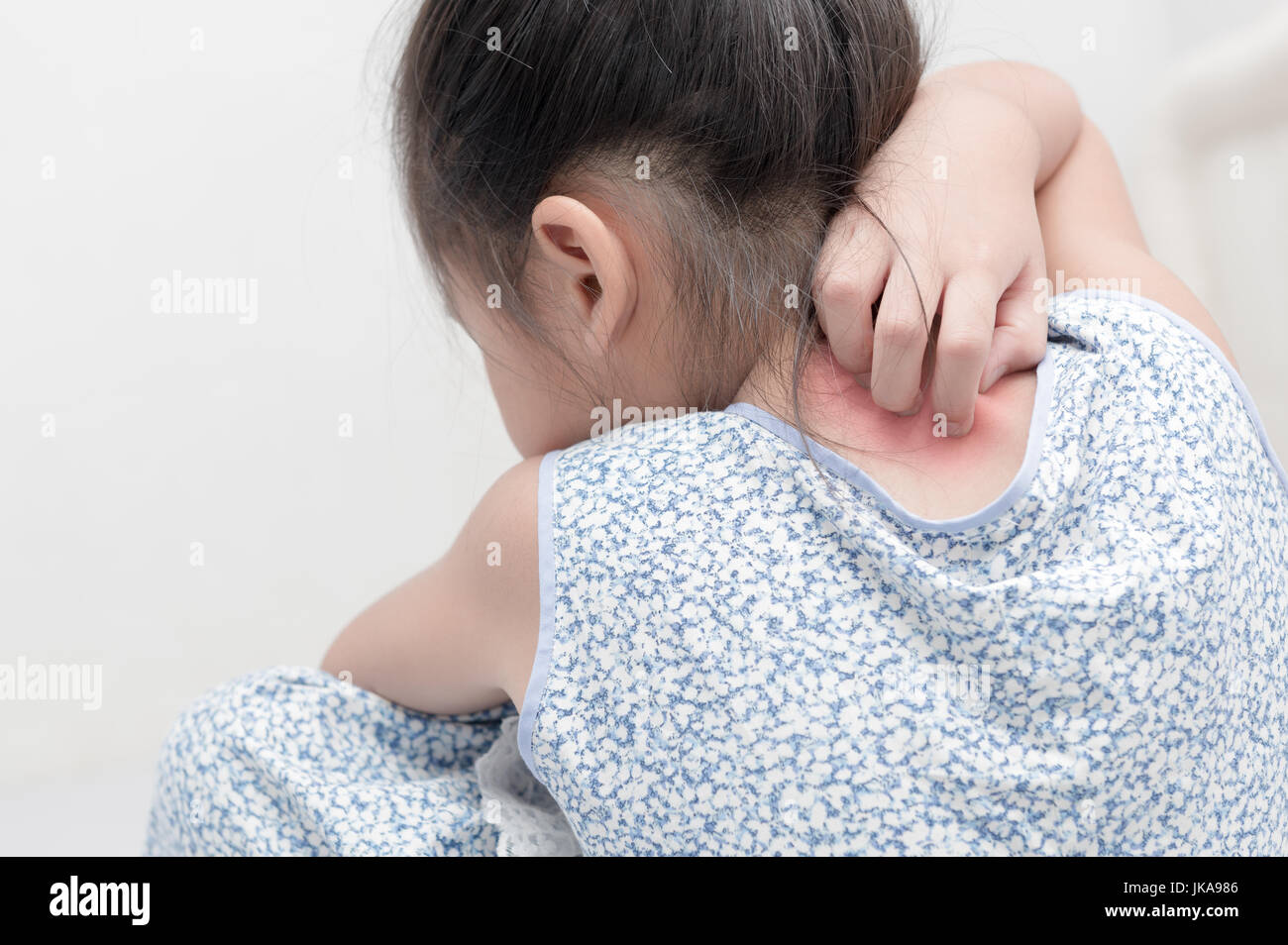 Shoulder scratch hi-res stock photography and images - Alamy