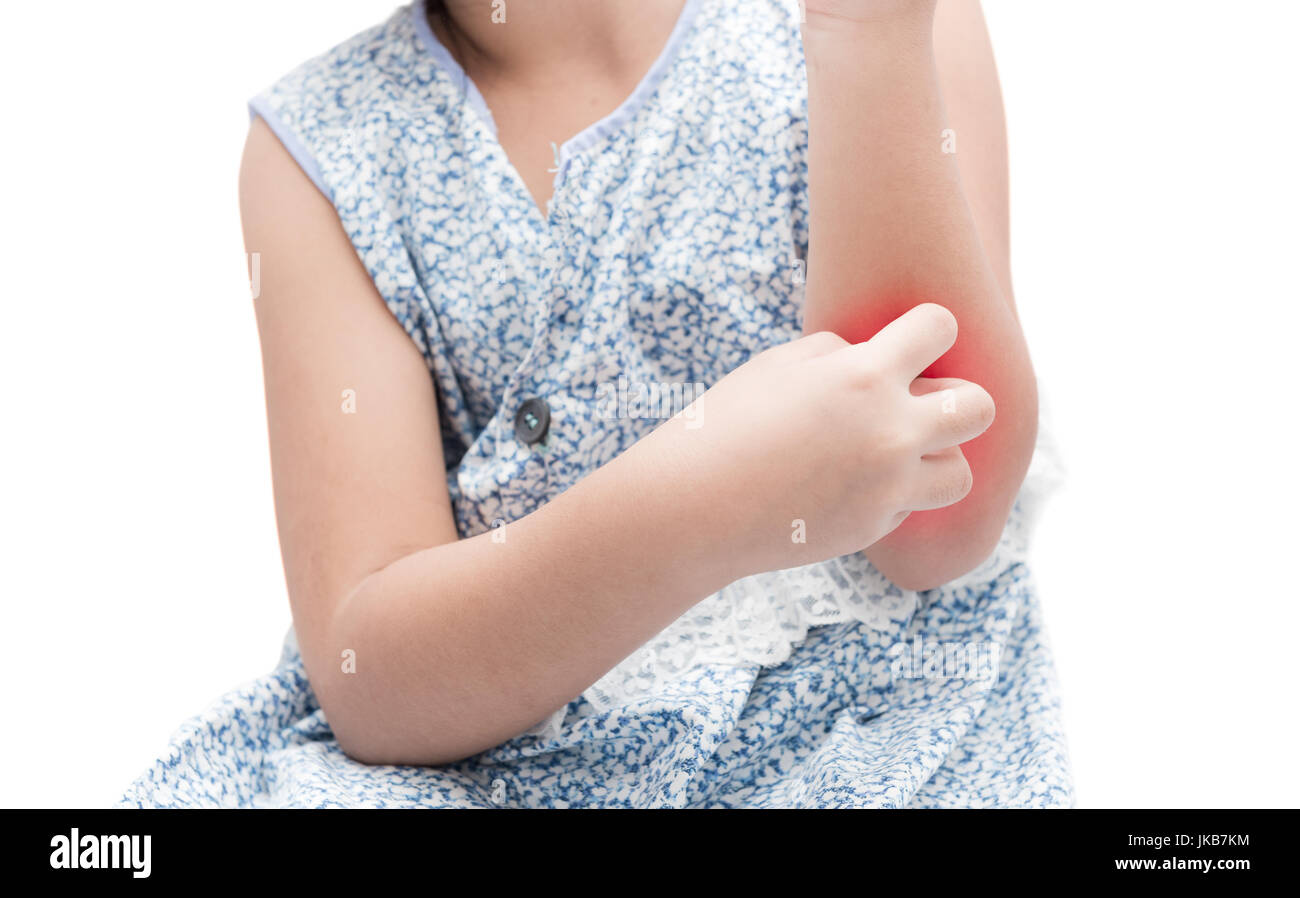 Girl scratching arm hi-res stock photography and images - Alamy