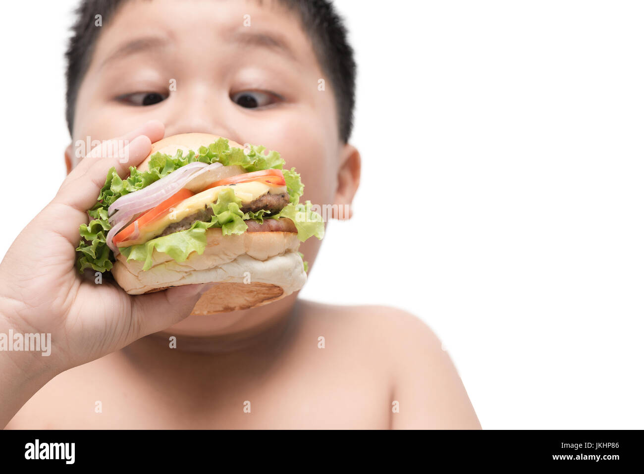 Morbidly obese boy hi-res stock photography and images - Alamy
