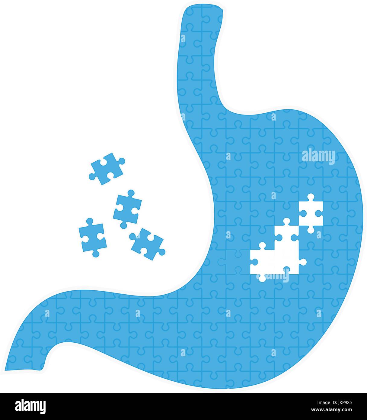 Gastrectomy illustration Stock Vector Images - Alamy