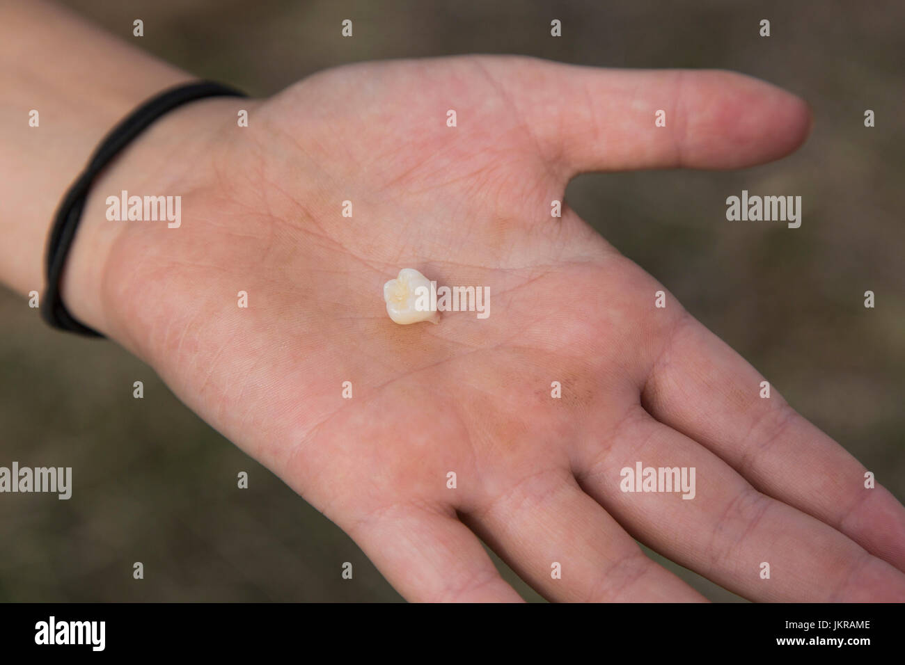 High angle view of hand showing tooth Stock Photo - Alamy