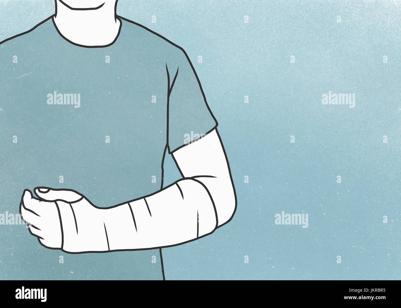 Fractured hand hi-res stock photography and images - Alamy