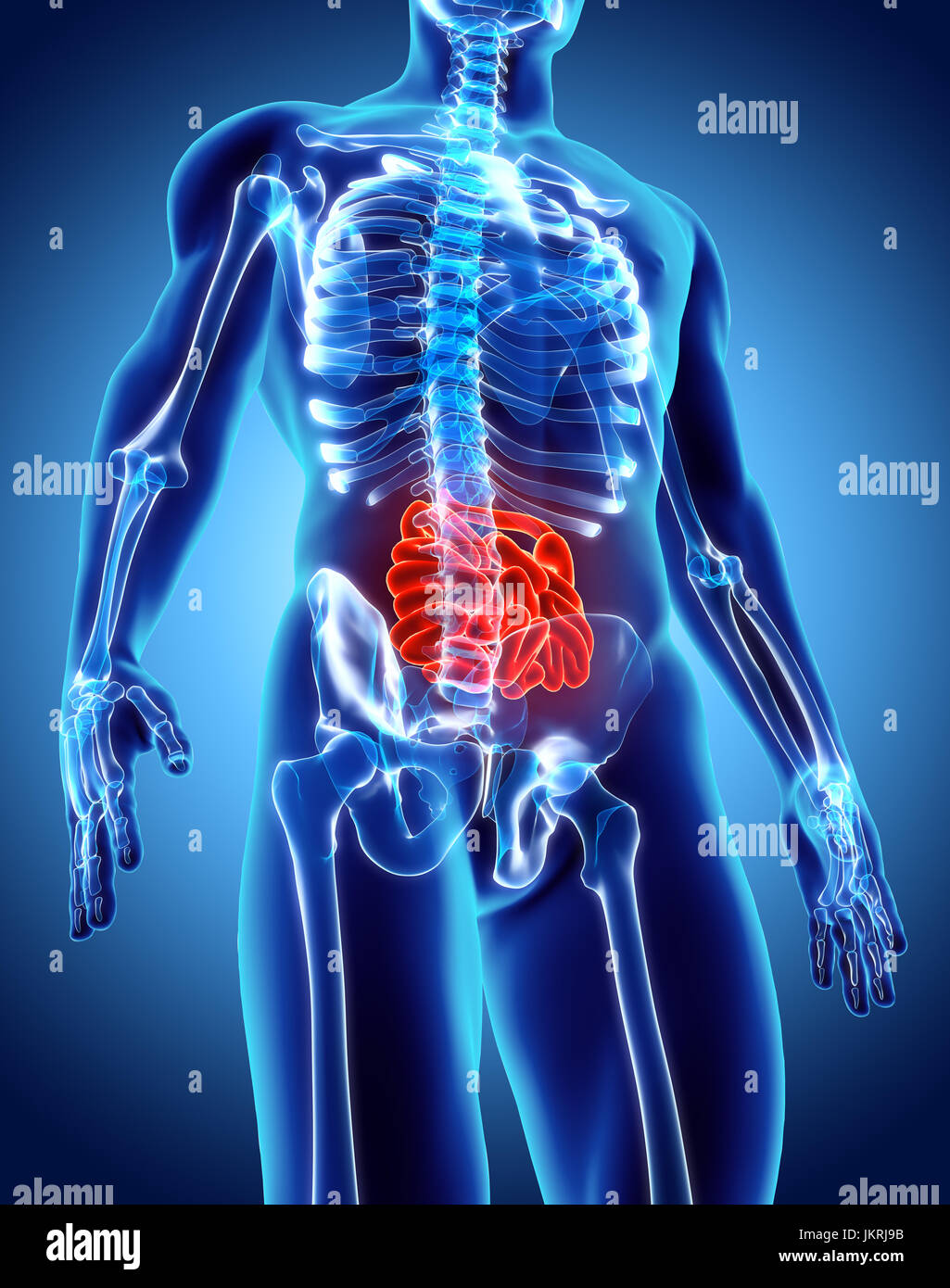 Inflamed intestines hi-res stock photography and images - Alamy