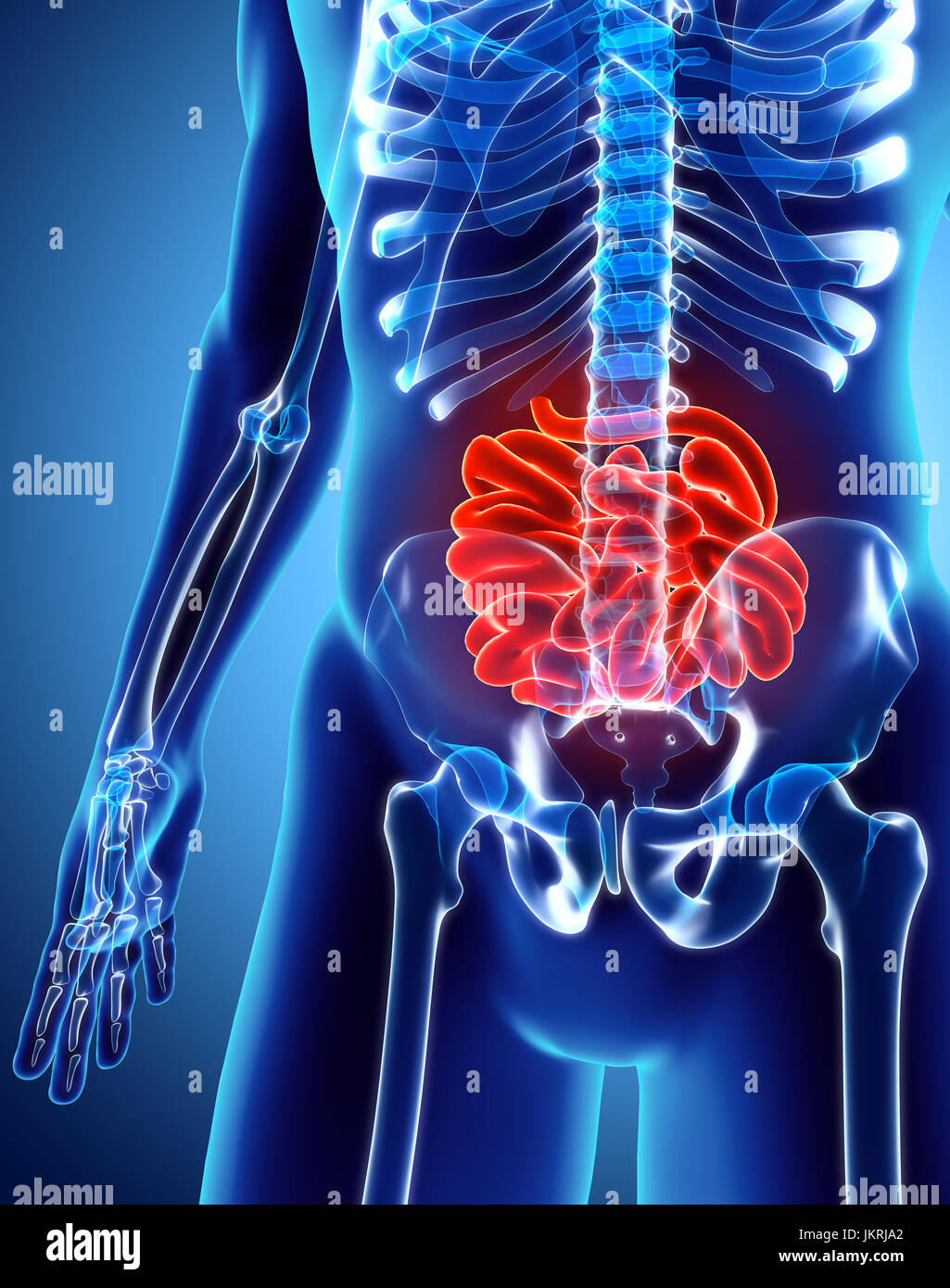 Inflamed intestinal villi hi-res stock photography and images - Alamy