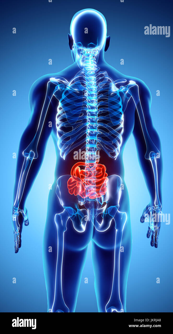Inflamed small intestine hi-res stock photography and images - Alamy