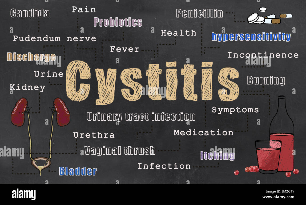 Illustration of Cystitis with Classic old drawing Style Stock Photo - Alamy
