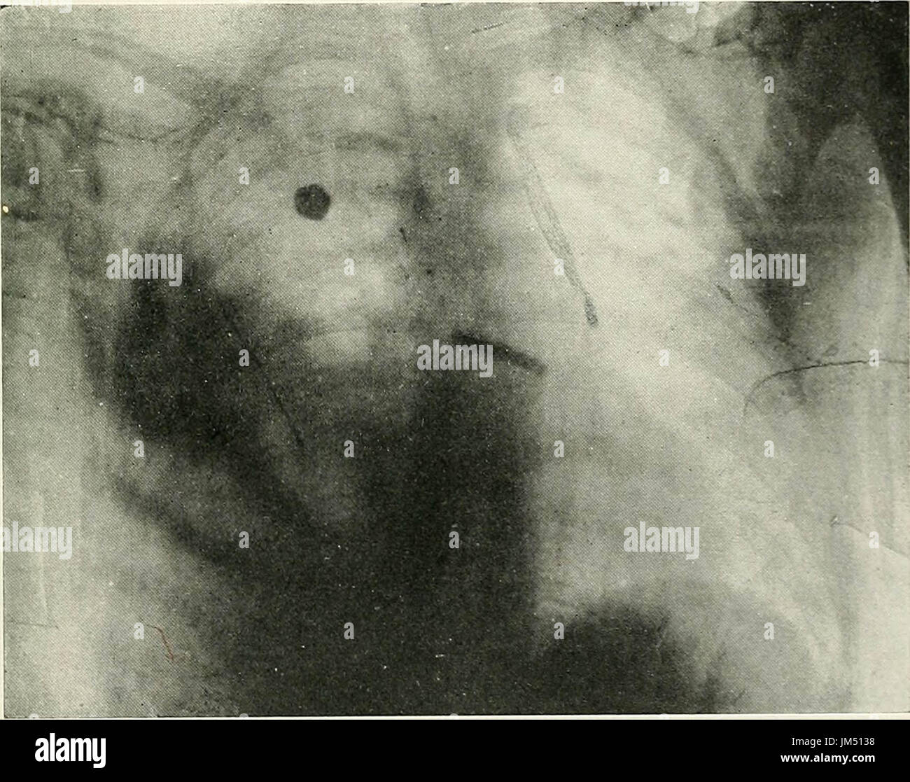 "Radio-diagnosis of pleuro-pulmonary affection" (1918 Stock Photo - Alamy