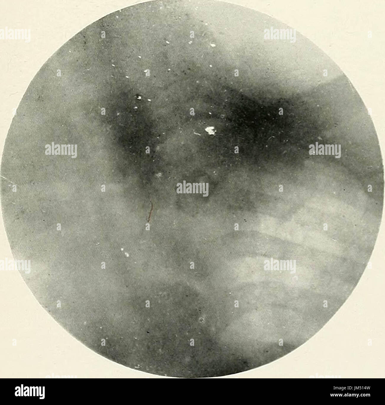 "Radio-diagnosis of pleuro-pulmonary affection" (1918 Stock Photo - Alamy