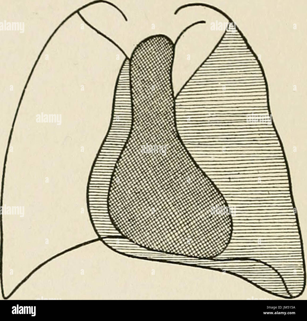 "Radio-diagnosis of pleuro-pulmonary affection" (1918 Stock Photo - Alamy
